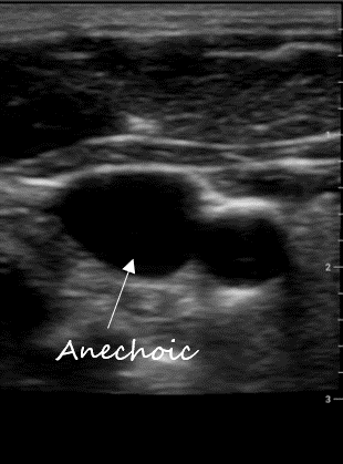 The Basics – Toronto Internal Medicine POCUS