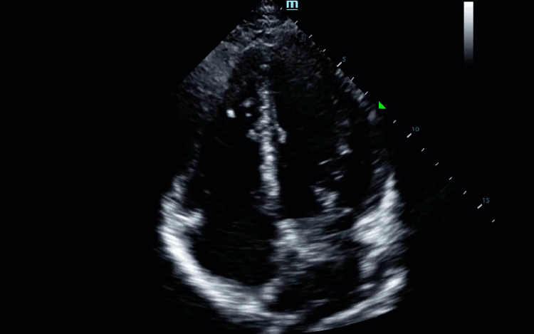 Cardiac Views – Toronto Internal Medicine POCUS