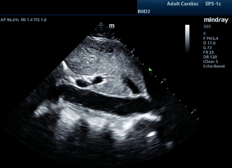 Cardiac Views – Toronto Internal Medicine POCUS