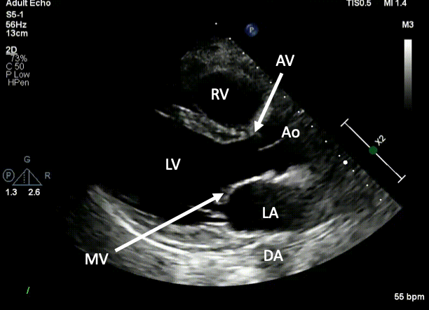 Cardiac Views – Toronto Internal Medicine POCUS