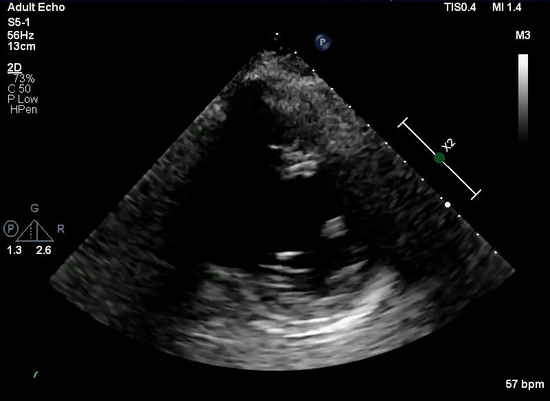 Cardiac Views – Toronto Internal Medicine POCUS