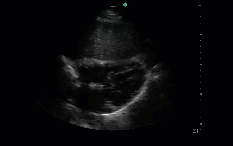 Cardiac Views – Toronto Internal Medicine POCUS