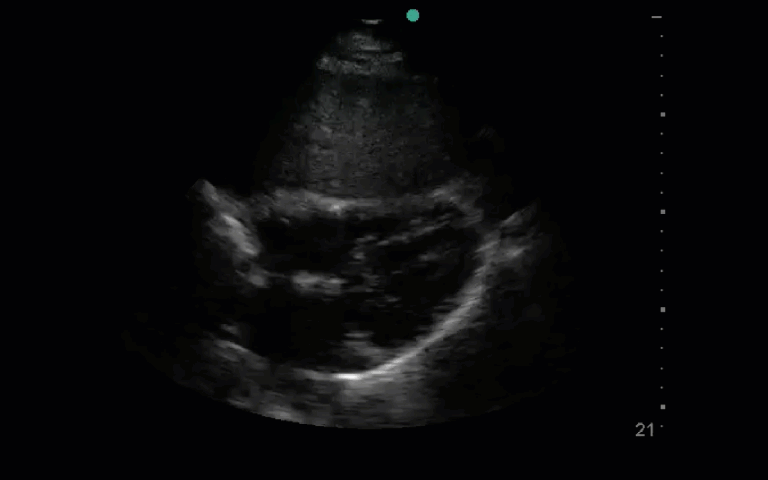 Cardiac Views – Toronto Internal Medicine POCUS