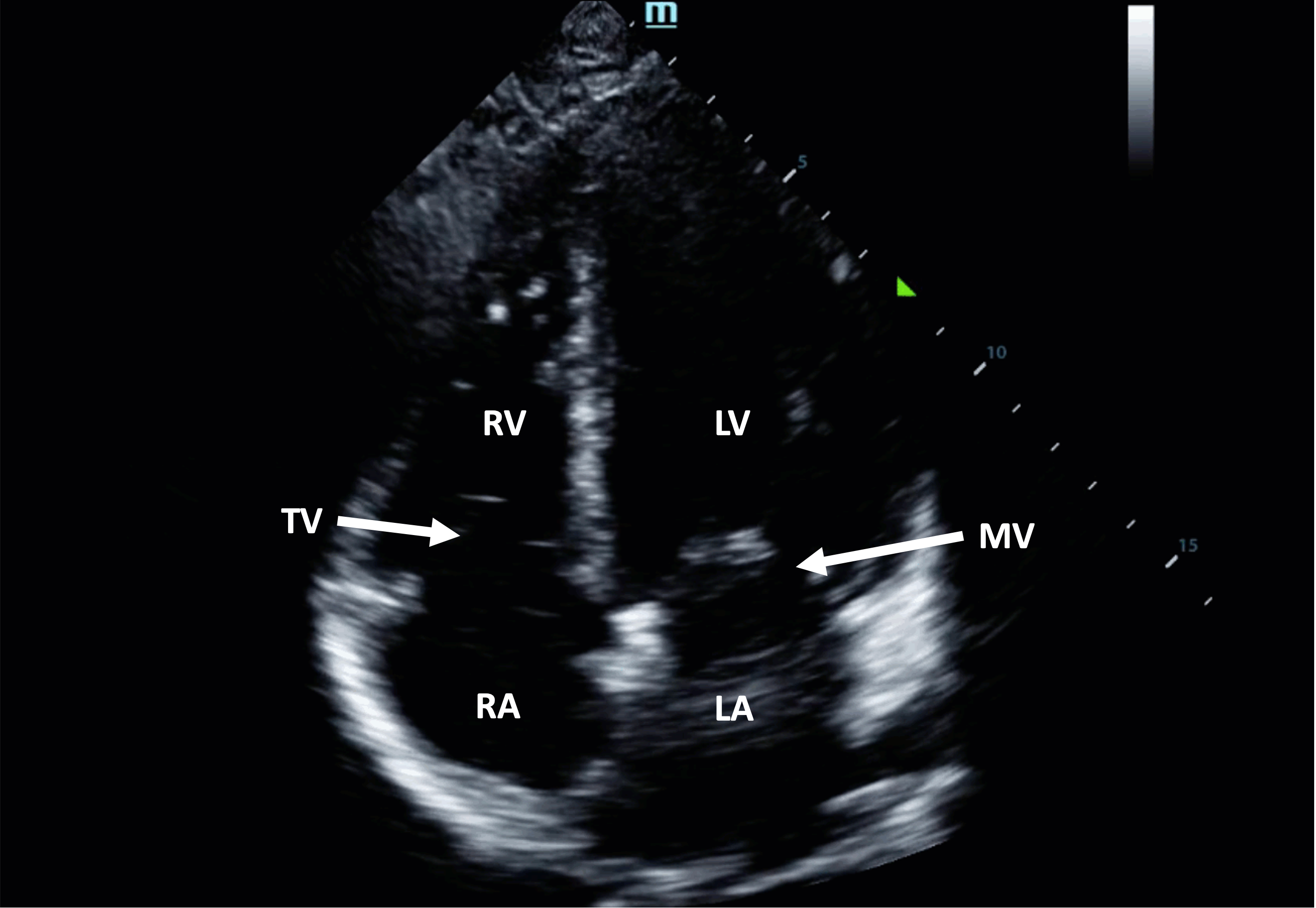 Cardiac Views – Toronto Internal Medicine POCUS