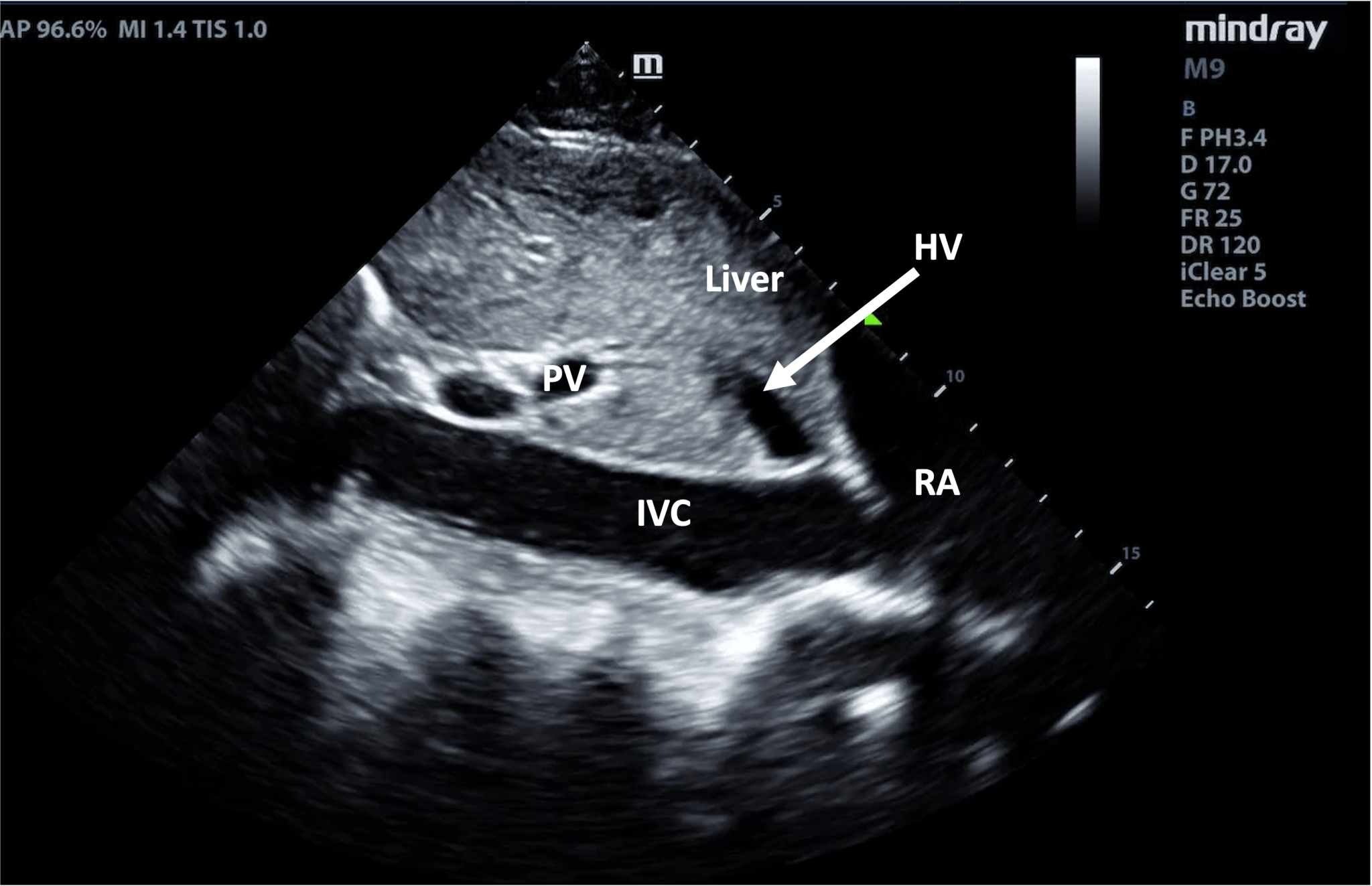 Cardiac Views – Toronto Internal Medicine POCUS
