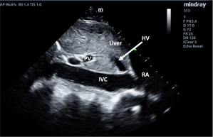 Cardiac Views – Toronto Internal Medicine POCUS